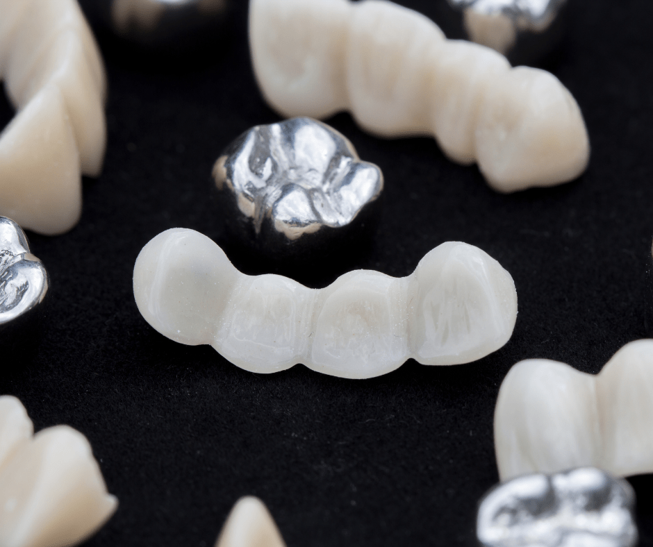Metal Crowns - Best Dental Clinic in Bangalore | Dentick Dental Care
